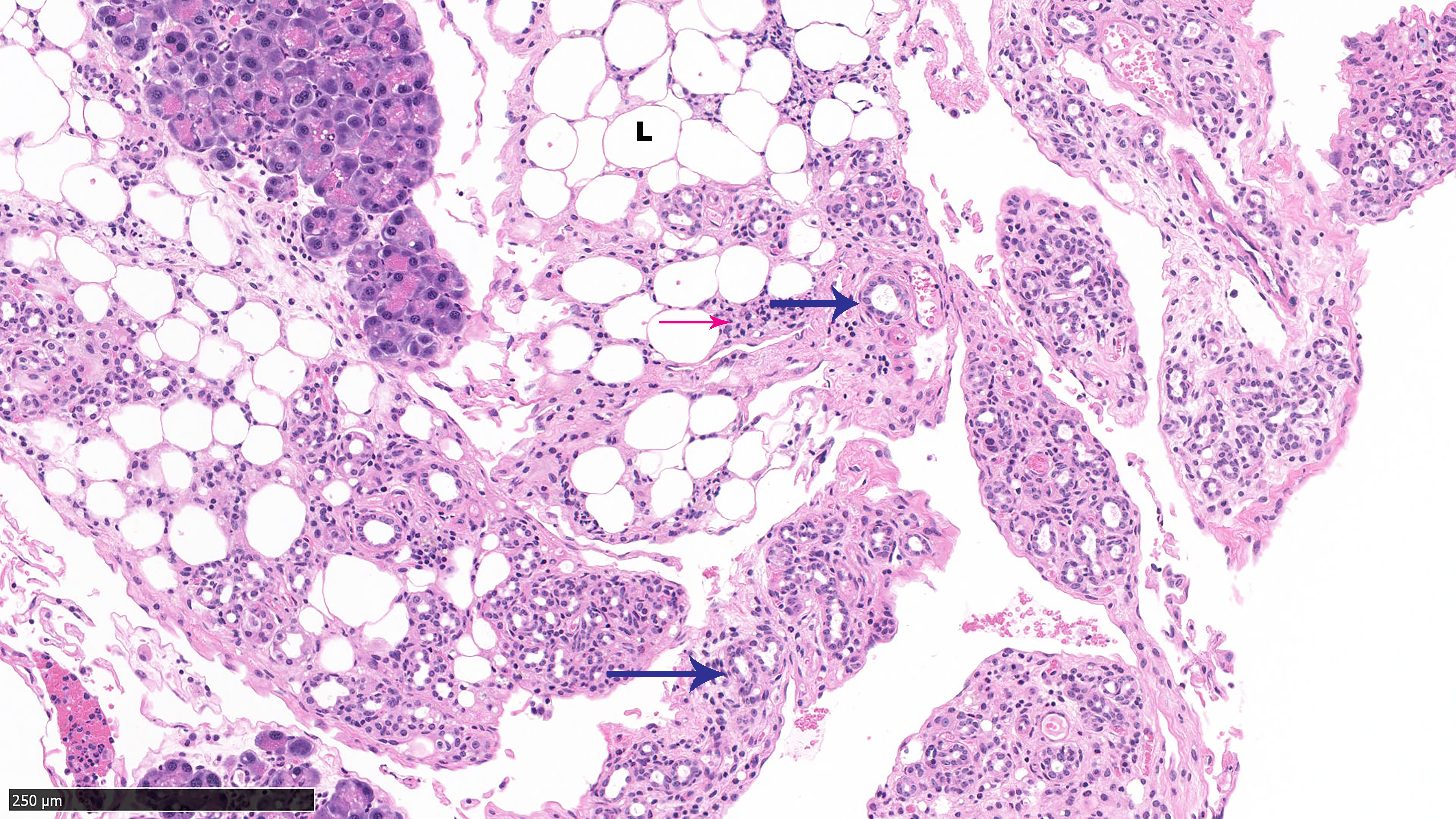Featured Lesion #9 – Geropathology Research Network