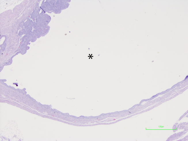 Featured Lesion #18 – Geropathology Research Consortium